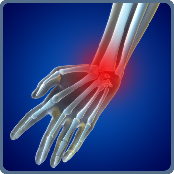 Chicago Chiropractic - Carpal Tunnel Treatment